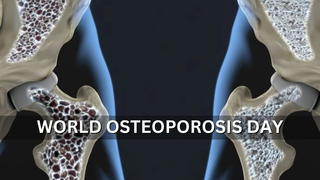 Building Better Bones: A Guide to World Osteoporosis Day 2023 – Doctor ...